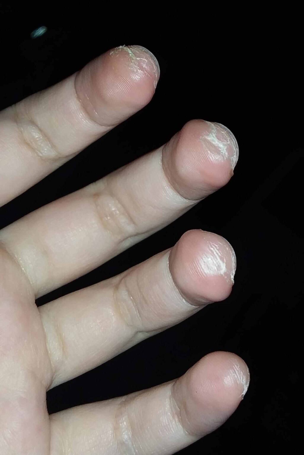 Is Learning Guitar Hard? Yes! But Don't Be Put Off - Guitar Inside Out